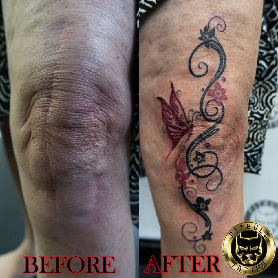 Over Scars Tattoo Specializations